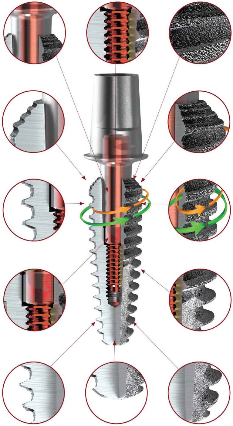 K3 Pro Rapid - Complete Dental Implant Solutions