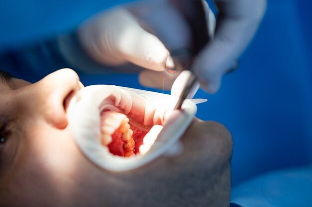 Morse Taper Dental Implants: Revolutionizing Stability & Health