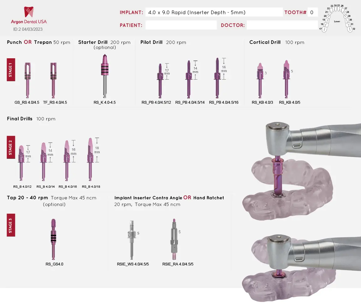 Choosing the Right Dental Implant System | Tips For Dentists